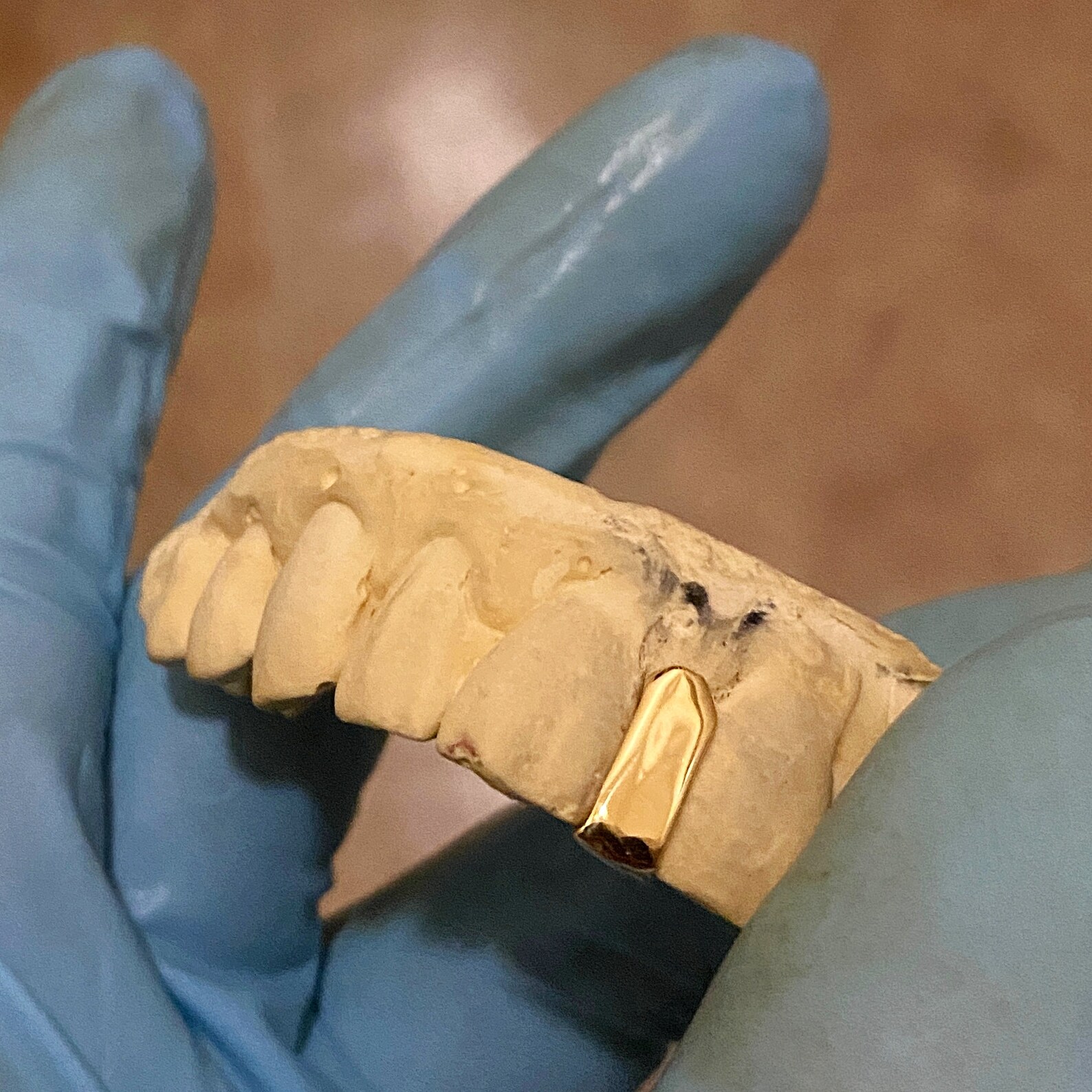 Real Solid 10K Gold or 14K or 18K Gold Single Gap Grill Custom - Etsy