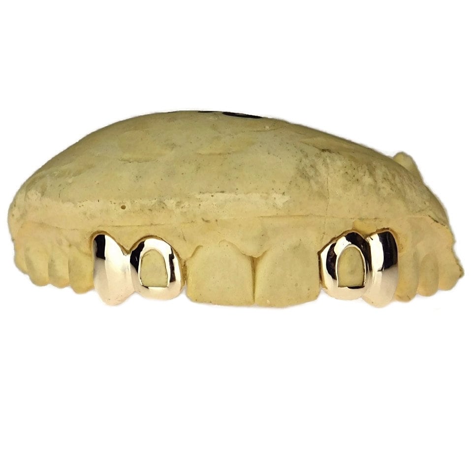 Removable Gold Tooth Cap