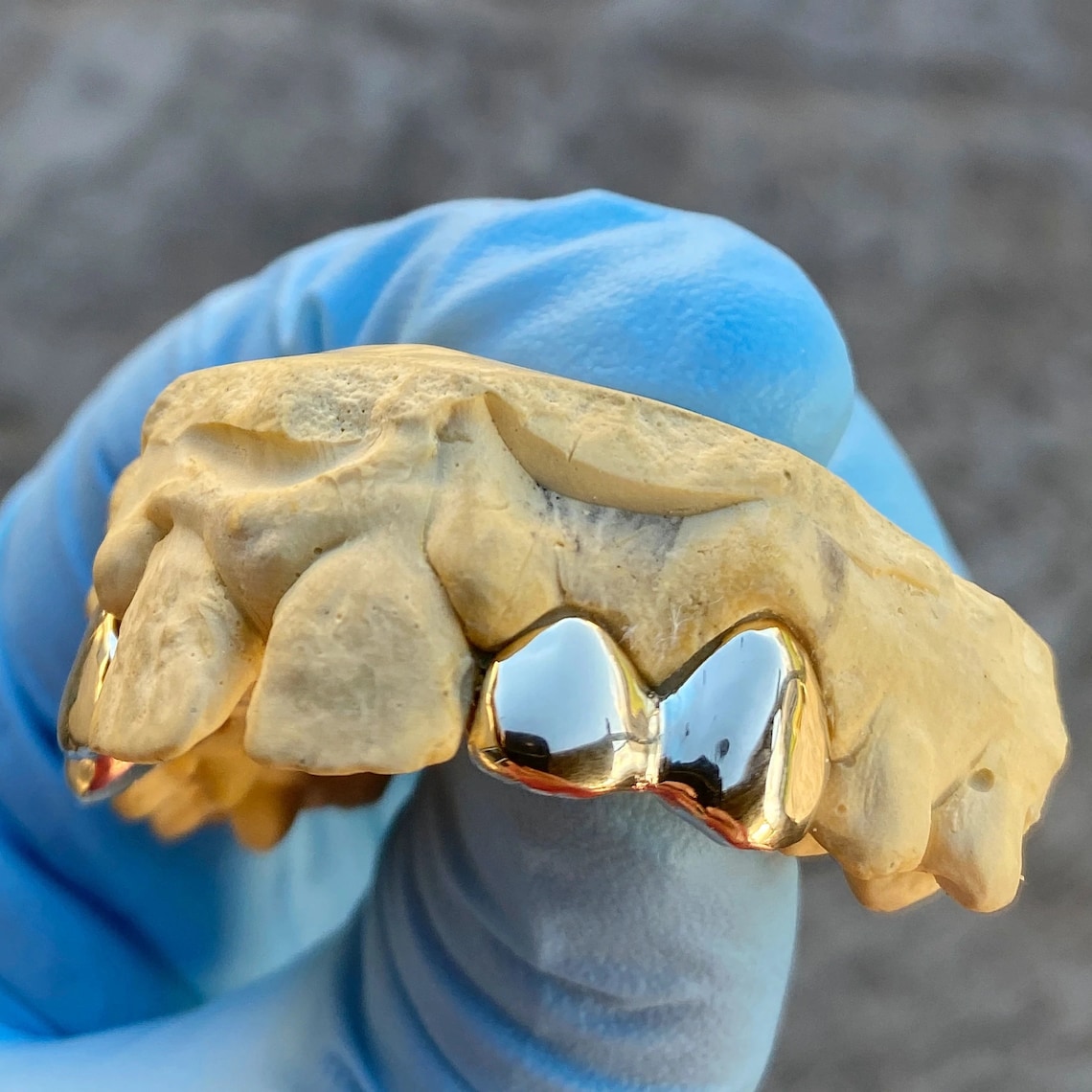 Real Solid 10K Gold Double Side Canine Teeth Custom Grillz - Etsy