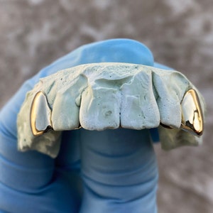 Gold Plated Custom Fitted Single Cap Grillz Set Real 925 Sterling ...