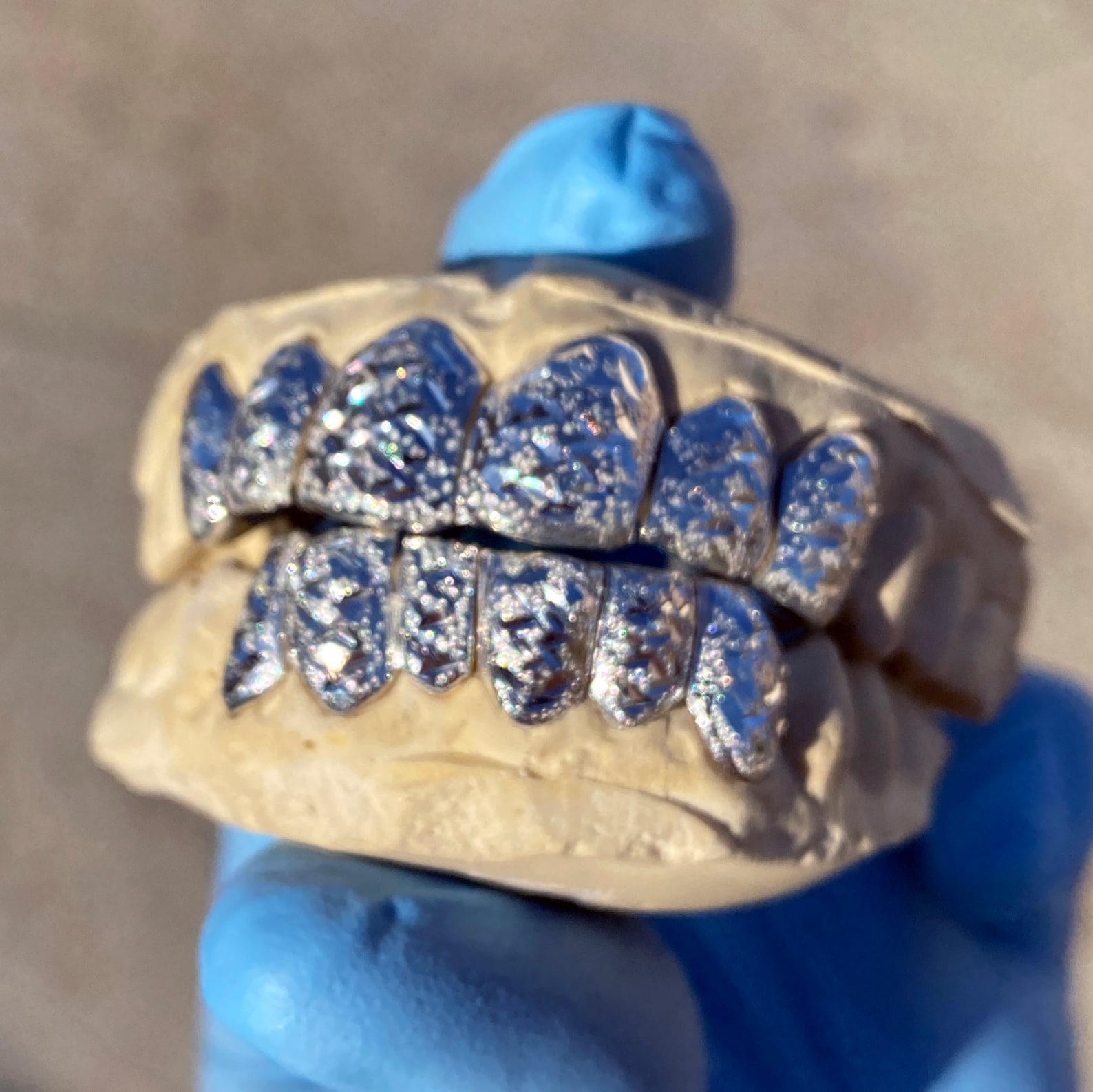 Solid 925 Sterling Silver Custom Teeth Grillz Permanent Look | Etsy