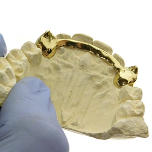 10K Gold OR 14K Gold Custom Fang Grillz Set Diamond Dust 2-tone 2 Single Cap Vampire Canine ...