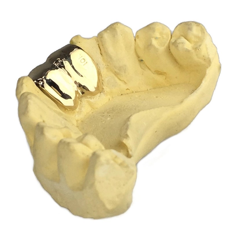 10K Gold Custom Grillz: Two Front Teeth Double Cap - Etsy