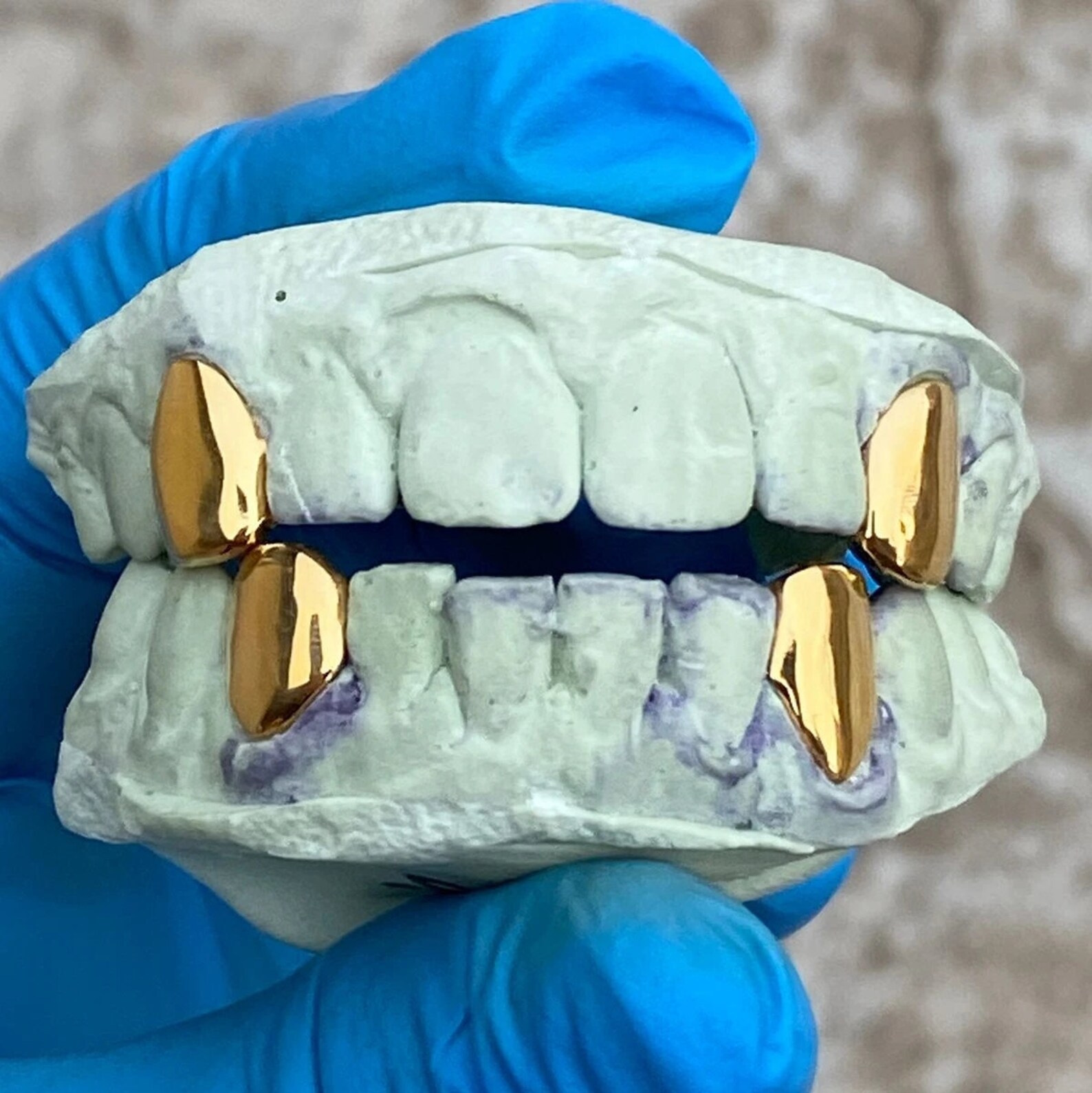 Gold Plated Custom Fitted Single Cap Grillz Set Real 925 - Etsy