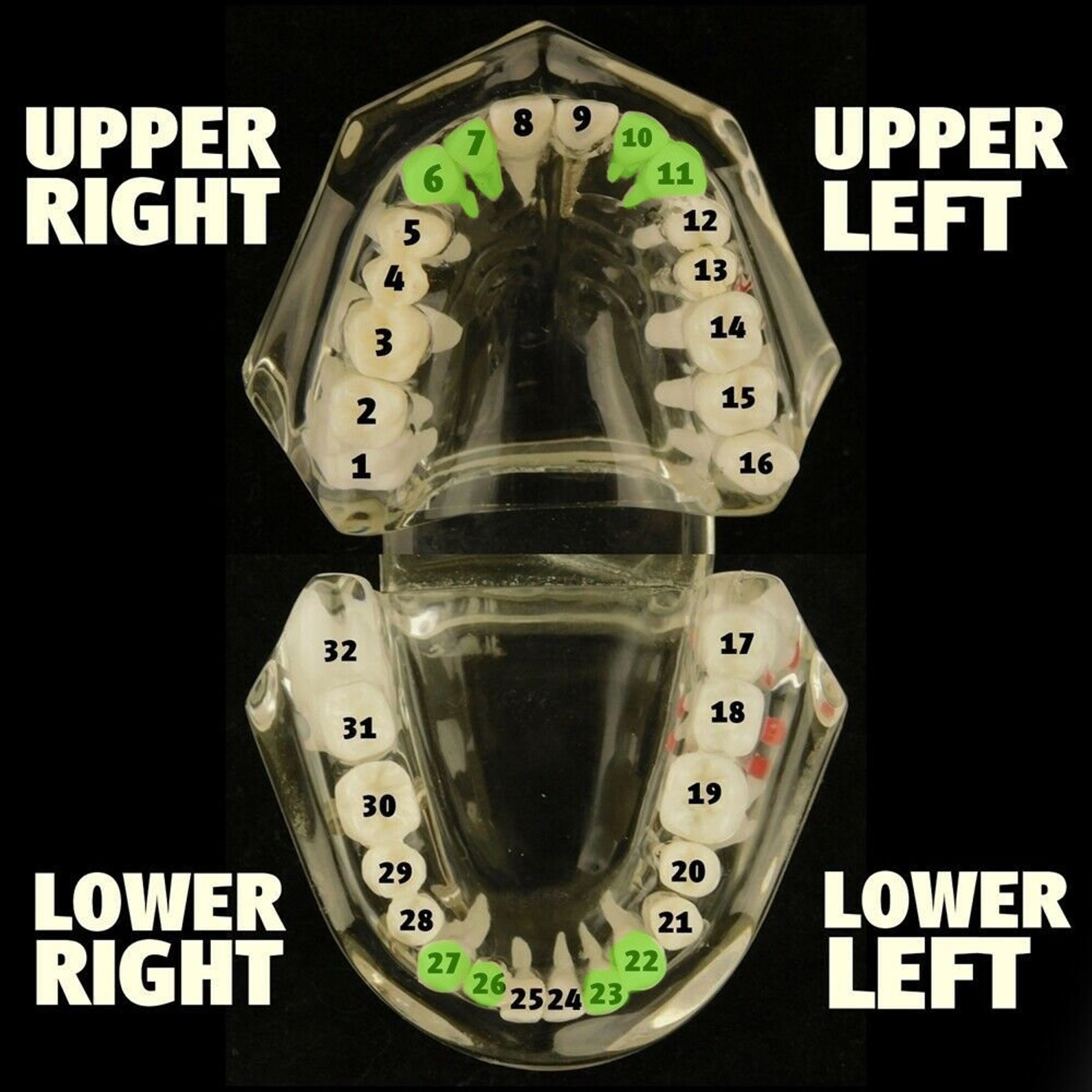 925 Sterling Silver Custom Fangs Grillz Set Double Caps | Etsy