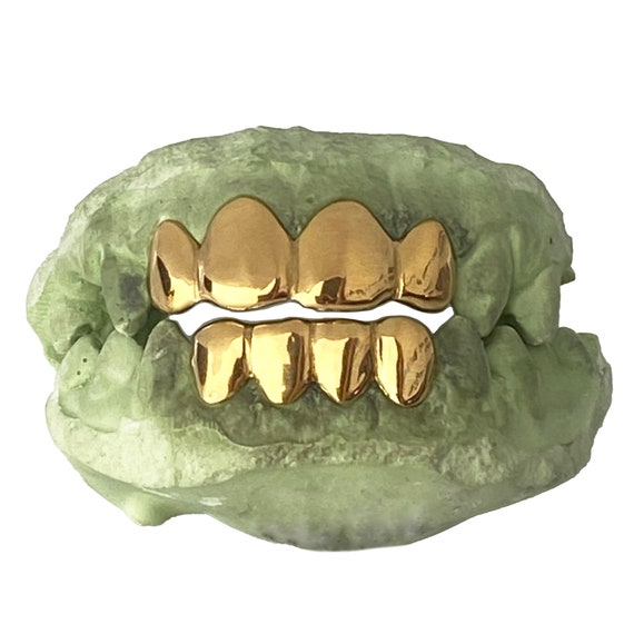 Single Gold Tooth Cap