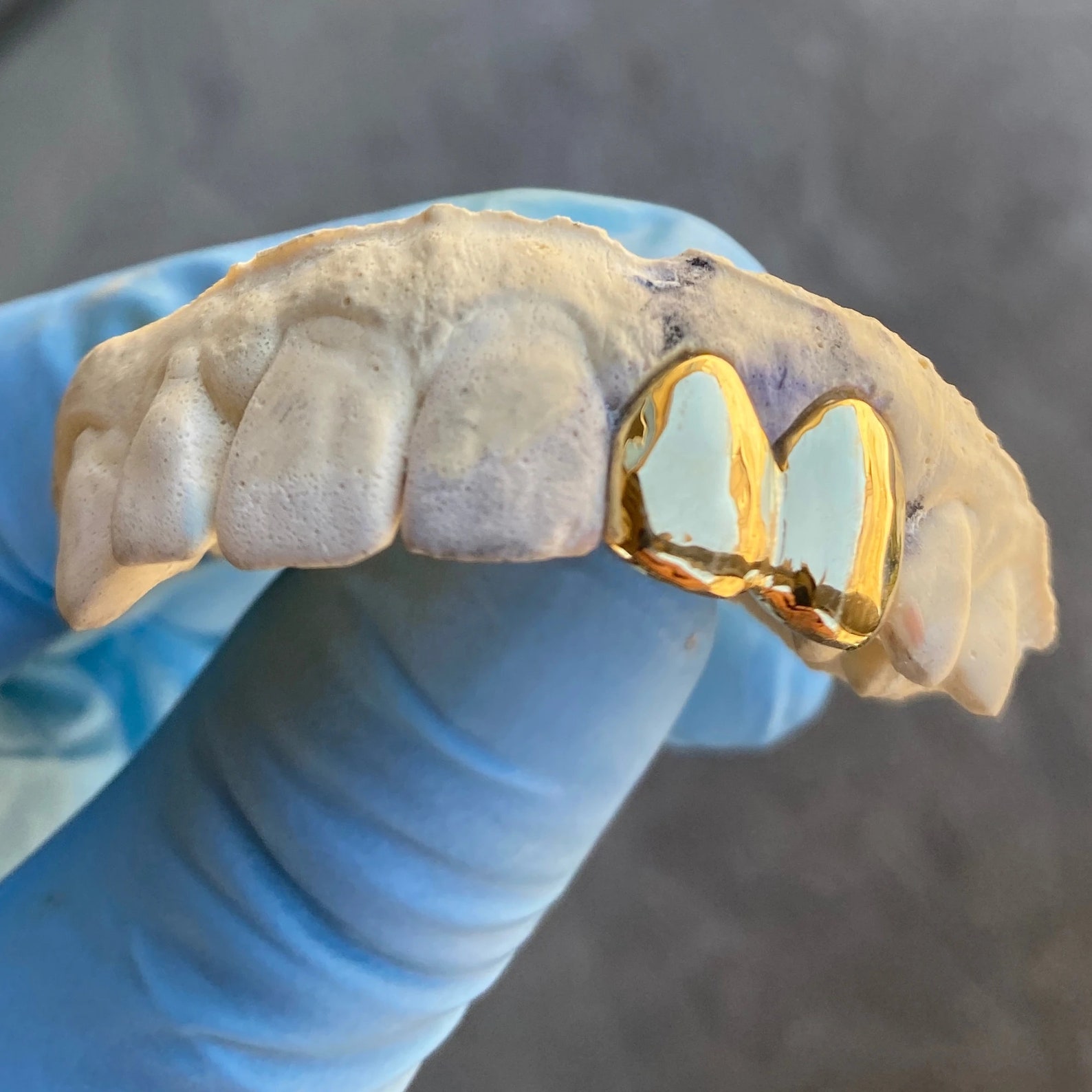 Real Solid 10K Gold Double Side Canine Teeth Custom Grillz - Etsy