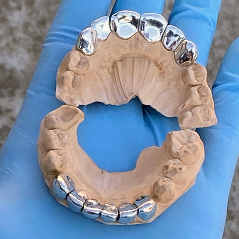 Solid 925 Sterling Silver Custom Teeth Grillz Permanent Look - Etsy