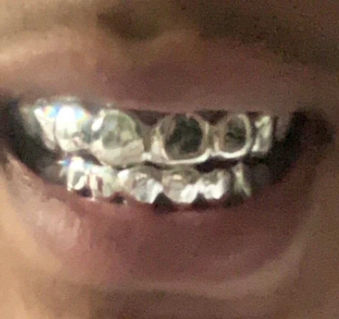 925 Sterling Silver Grillz Plain Teeth Custom Fitted Real - Etsy