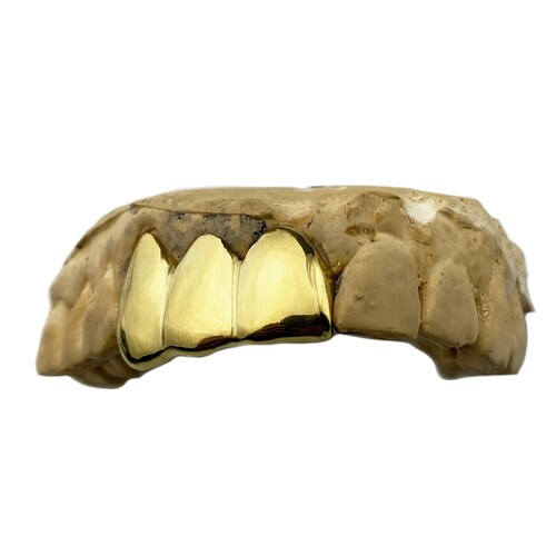 Real Solid 10K Gold Double Side Canine Teeth Custom Grillz - Etsy