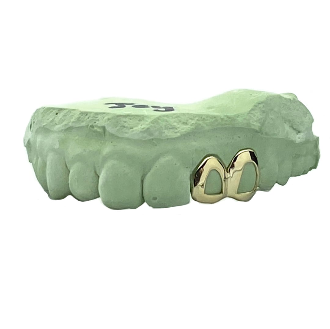 Solid 10k/14k Gold Canine Teeth Grillz - Custom Open Face Double Caps ...