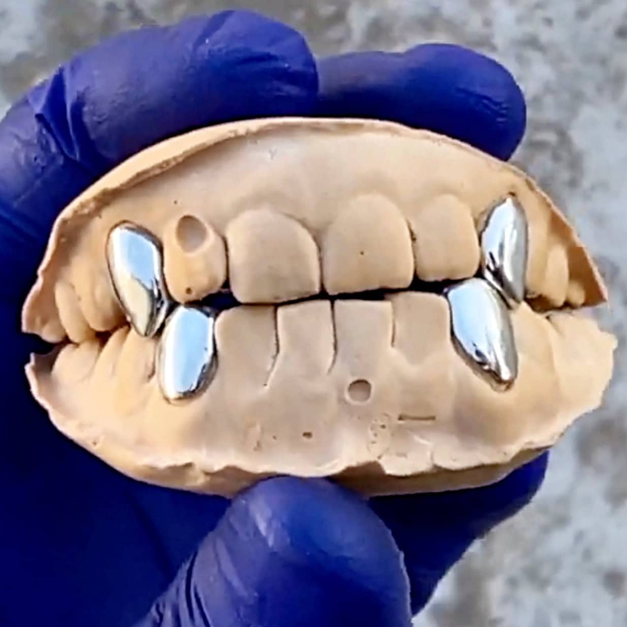 Removable Silver Tooth Cap