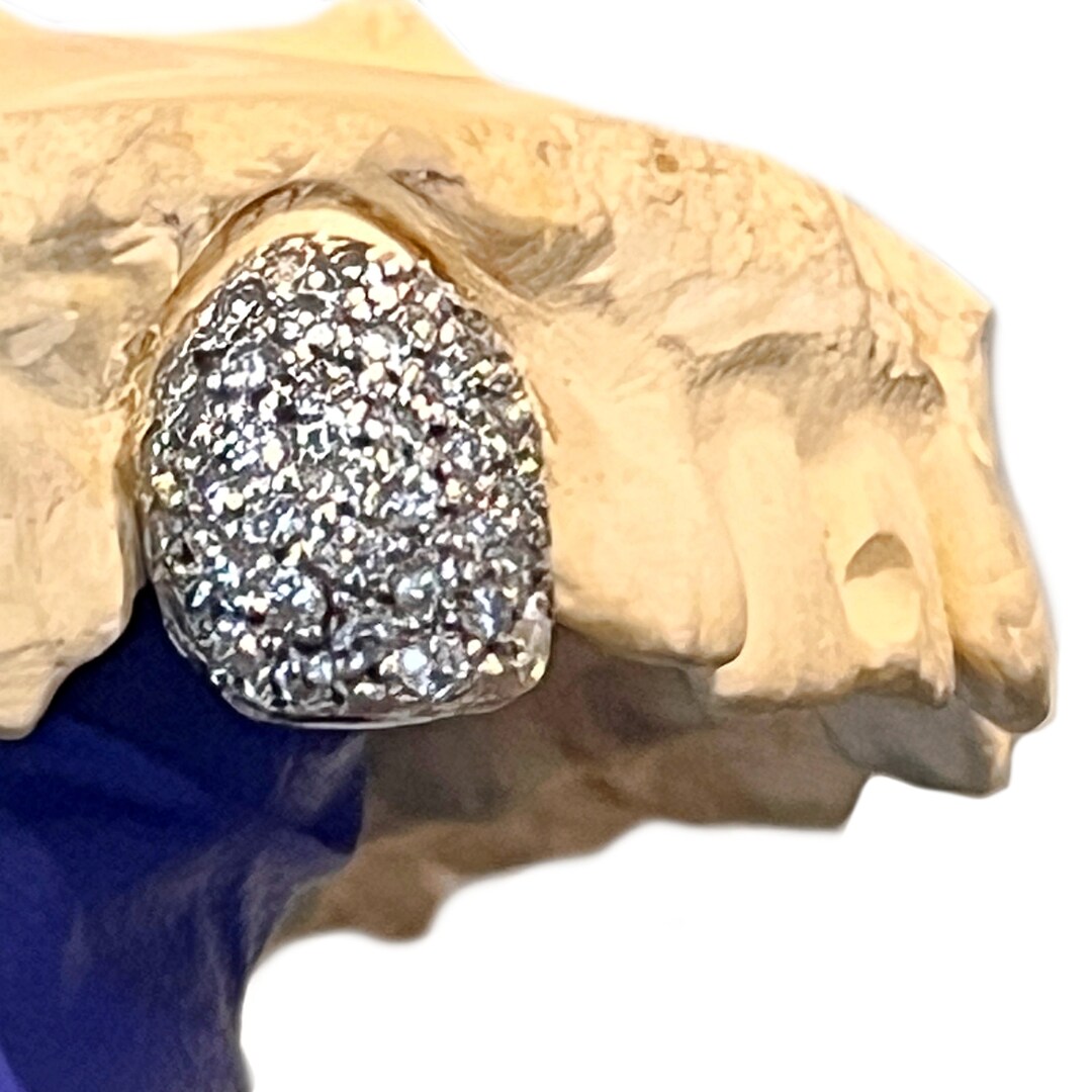 14K Gold CZ Iced Grillz: Custom Single Tooth Cap - Etsy