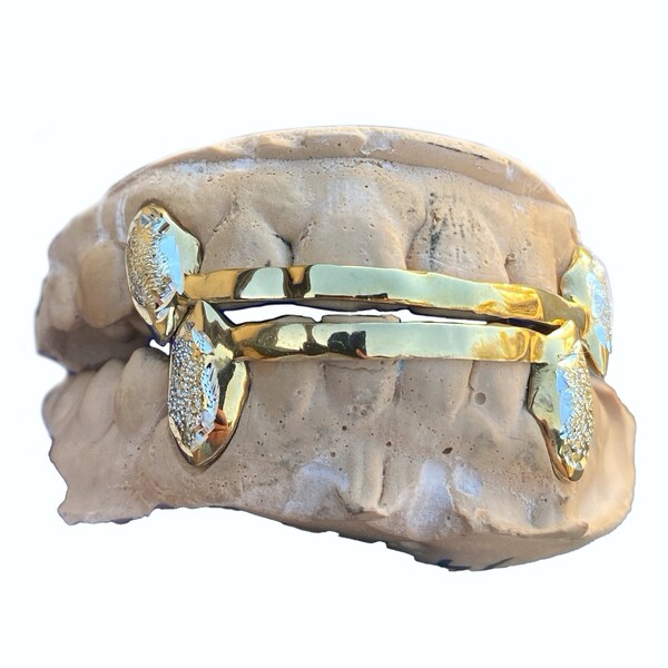 Diamond Teeth Grills - Etsy