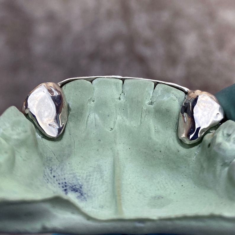 925 Sterling Silver Canine Teeth Bar Custom Grillz - Etsy