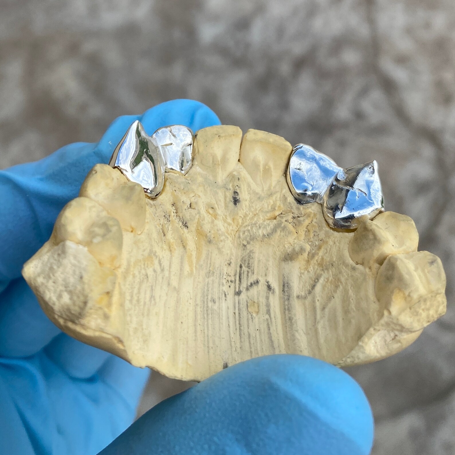 925 Sterling Silver Custom Fangs Grillz Set Double Caps | Etsy