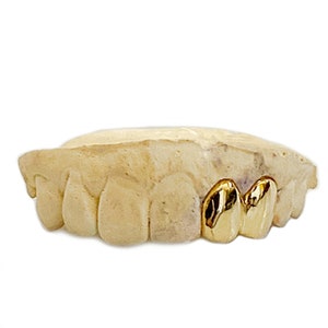 Real Solid 10K Gold Double Side Canine Teeth Custom Grillz - Etsy