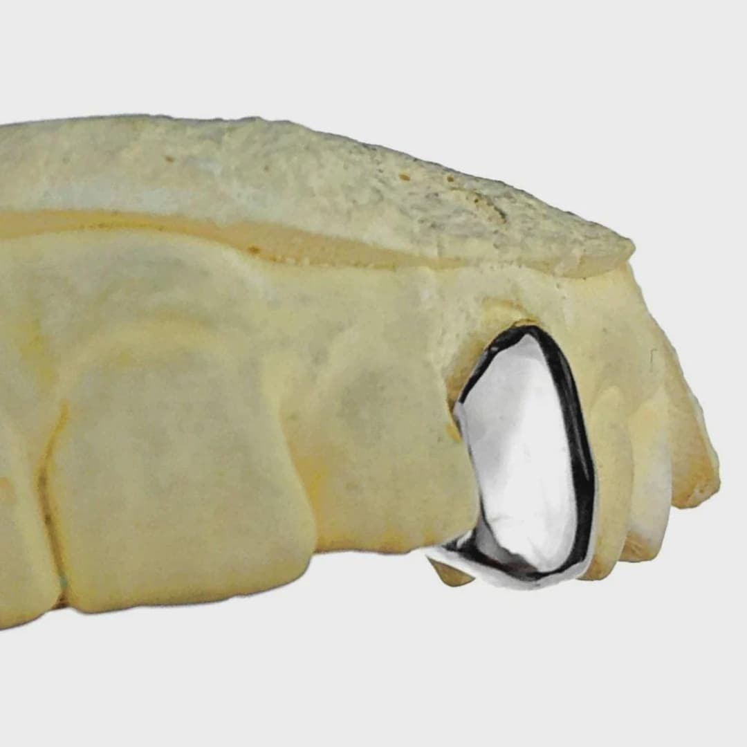 925 Sterling Silver Custom Grillz, Plain Single Tooth Cap - Etsy