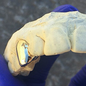Solid 10K Gold or 14K Gold or 18K Gold Custom Single Canine Caps Grillz ...