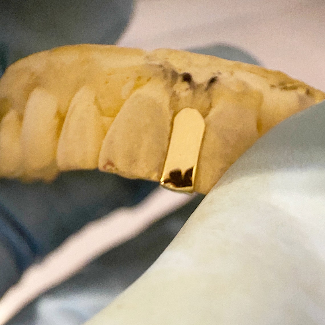 Real Solid 10K Gold or 14K or 18K Gold Single Gap Grill Custom - Etsy