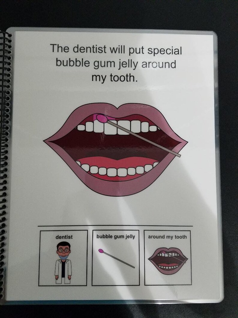 I Go to the Dentist Childrens Book (filling)- Dental-girl/ Social Story ...