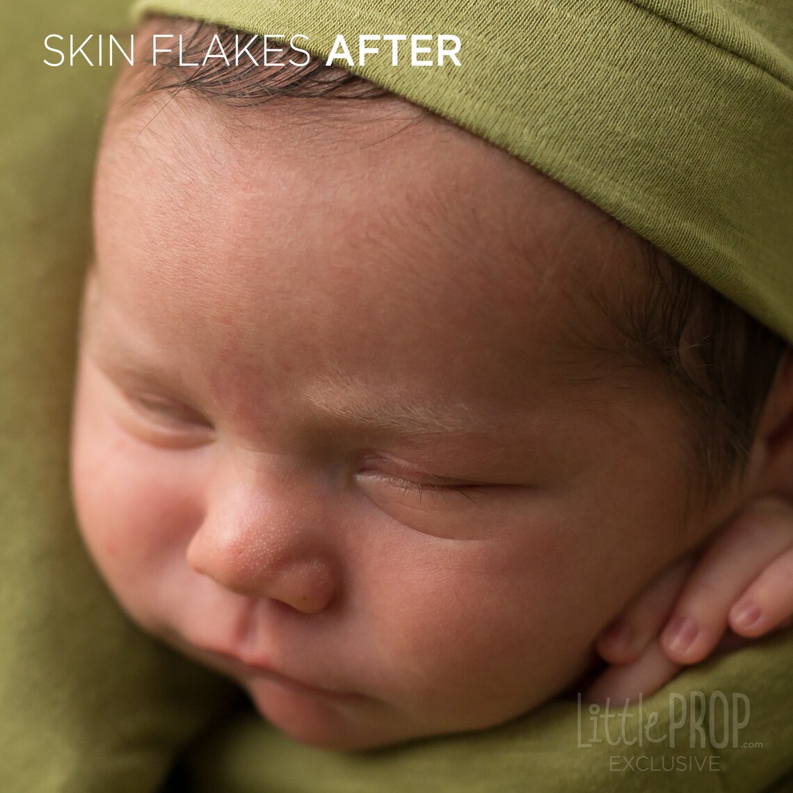 Skin Flakes Action Digital Download Newborn Editing Action | Etsy