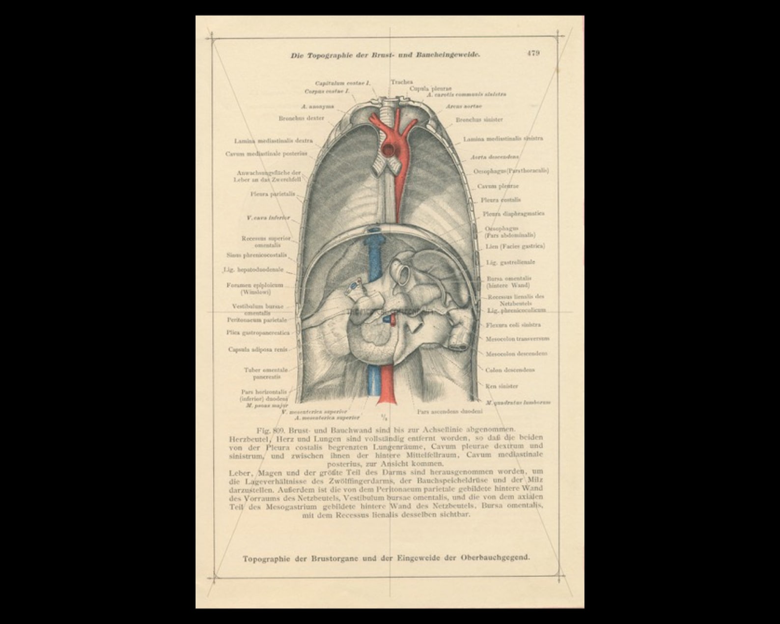 Antique Chest Anatomy Print | Autopsy | Rib Cage | Chest Cavity ...