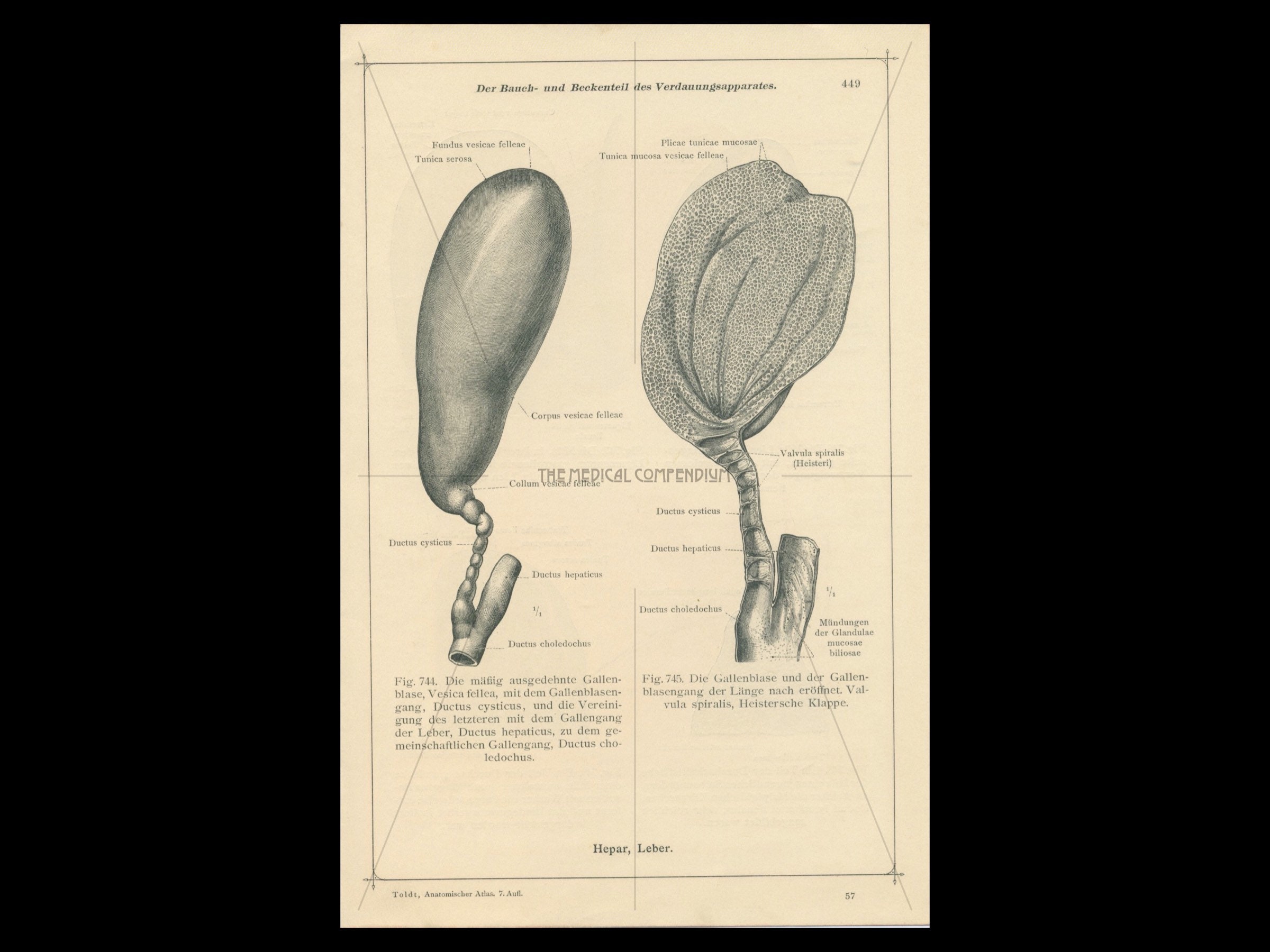 Antique Gallbladder Anatomy Print. Digestive System. Hepatology ...
