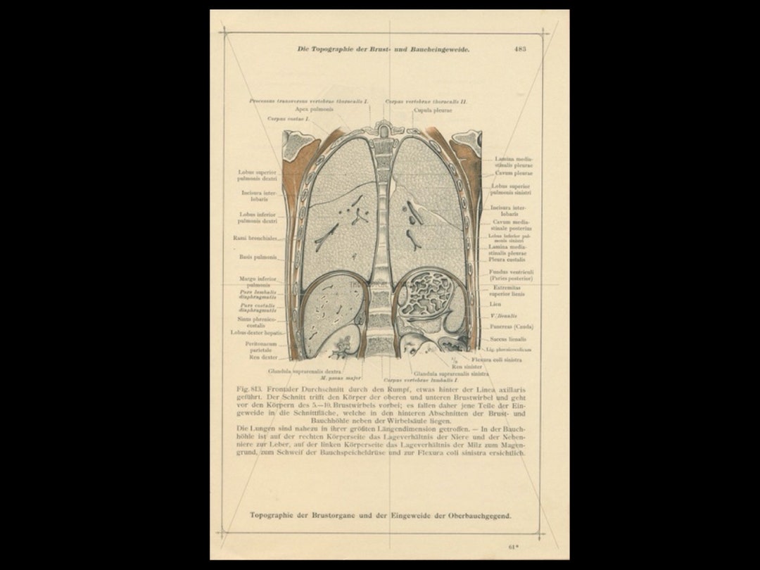 Antique Lung Cavity Print Chest Autopsy Rib Cage Chest Cavity Abdominal ...