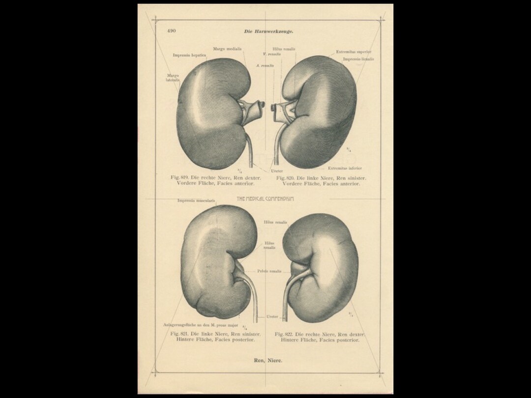 Antique Kidney Print Nephrology Medical Art Renal Organs Nephrologist ...