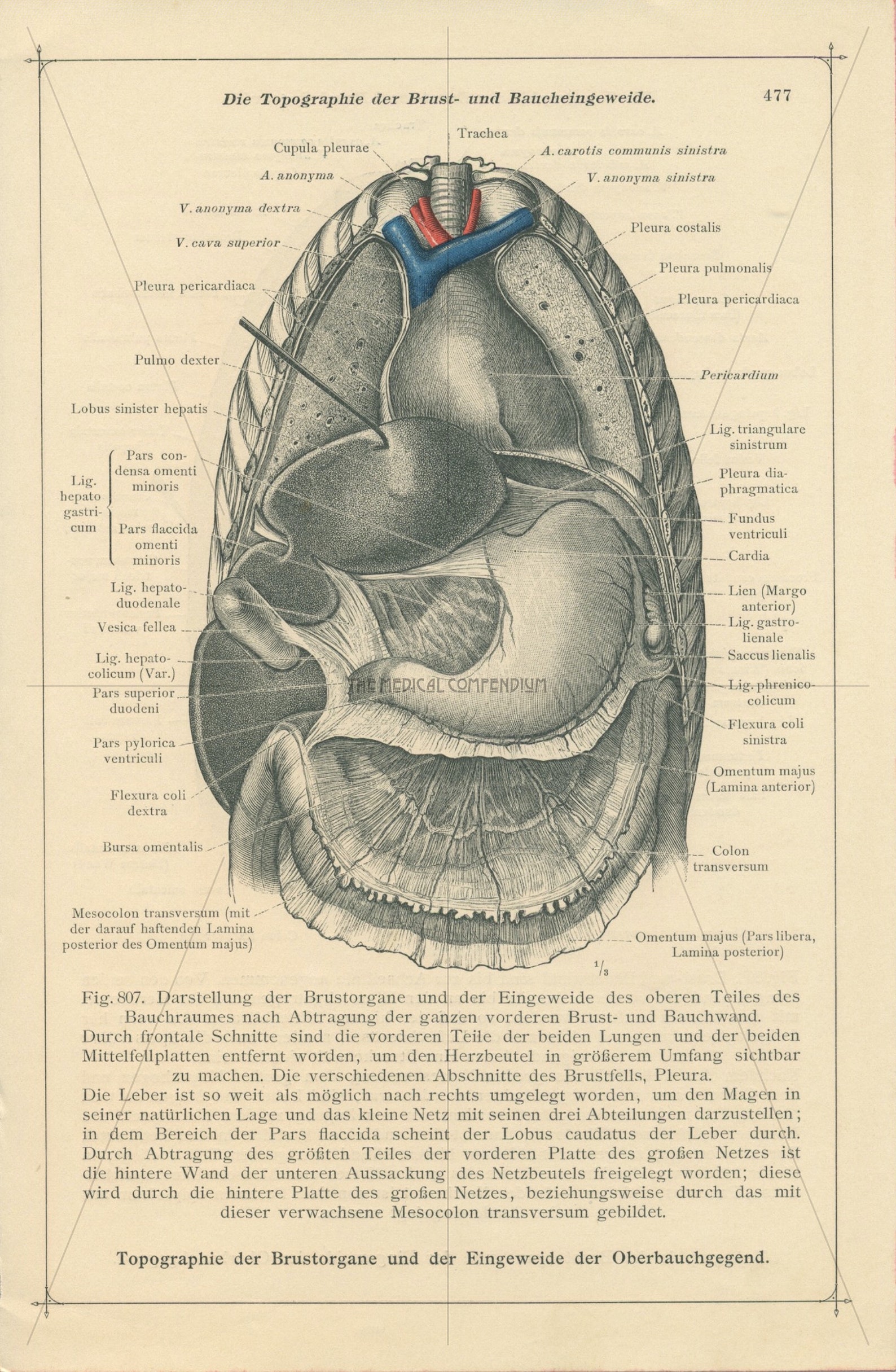 Antique Chest Anatomy Print | Autopsy | Rib Cage | Thorax | Chest ...
