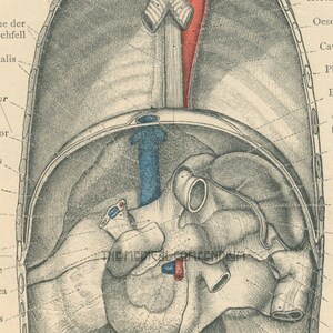 Antique Chest Anatomy Print | Autopsy | Rib Cage | Chest Cavity ...