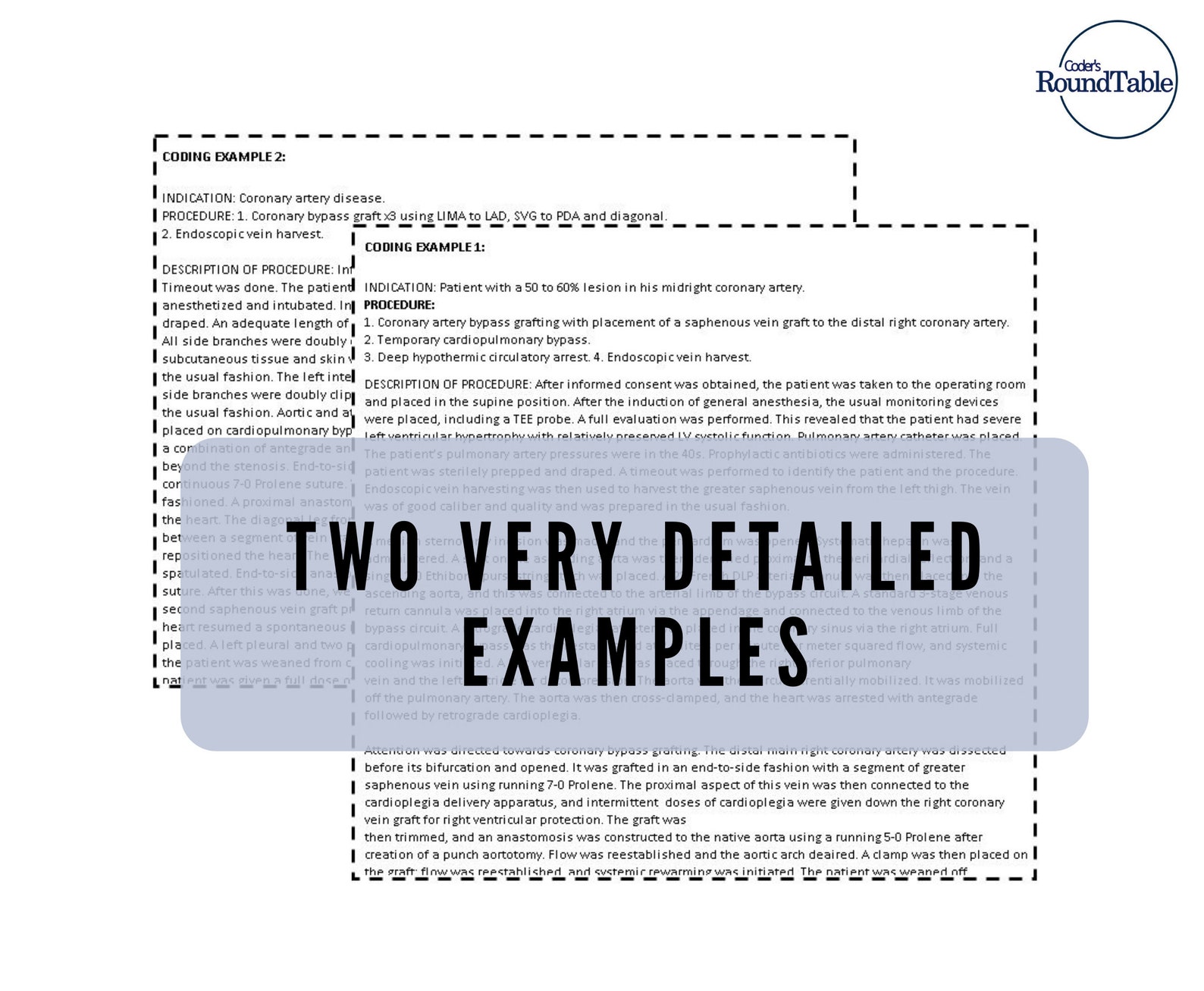 CABG Coding Cheat Sheet - Etsy