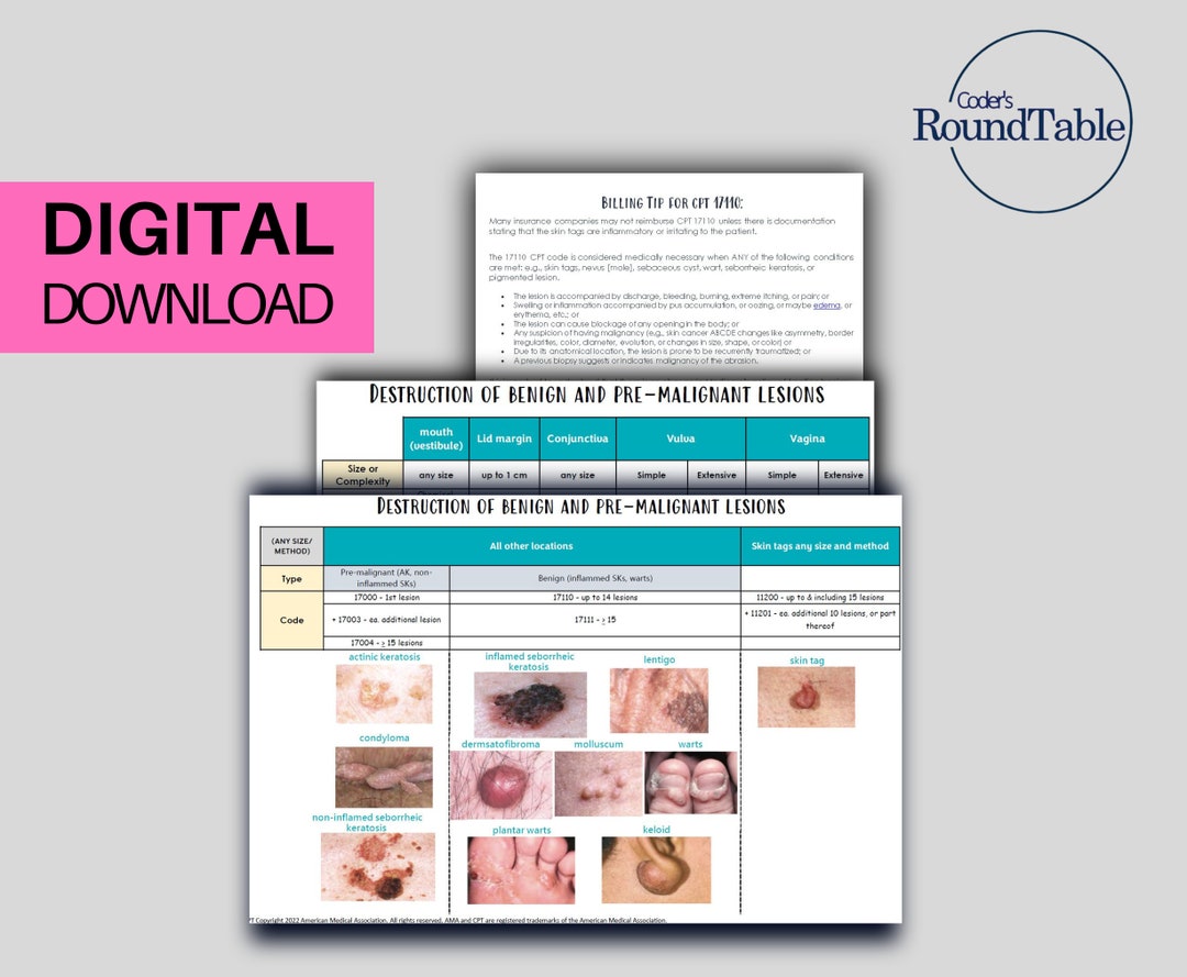 Coding Cheat Sheet for Destruction of Benign and Pre-malignant Lesions ...