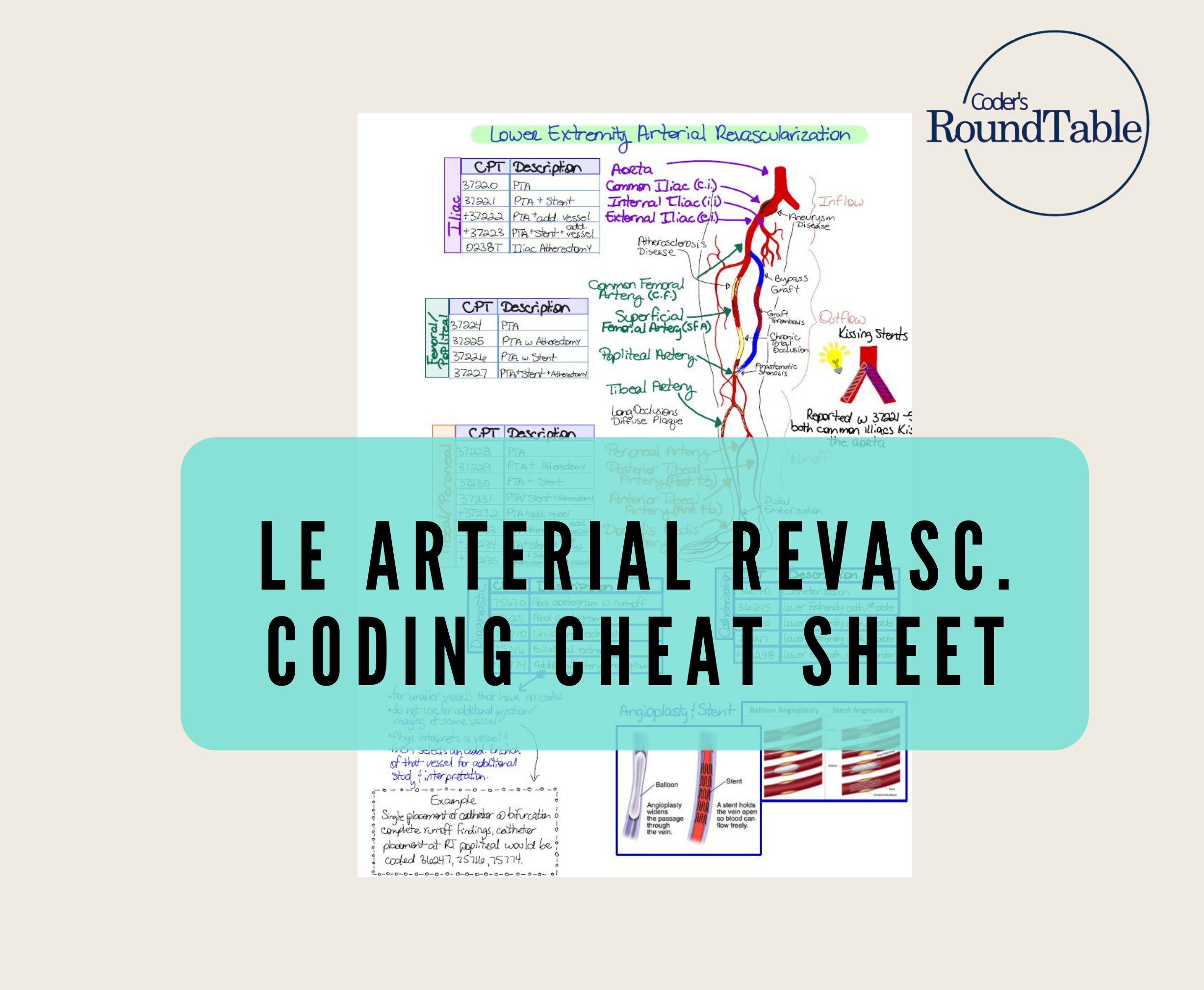 Lower Extremity Arterial Revascularization Coding Cheat Sheet - Etsy