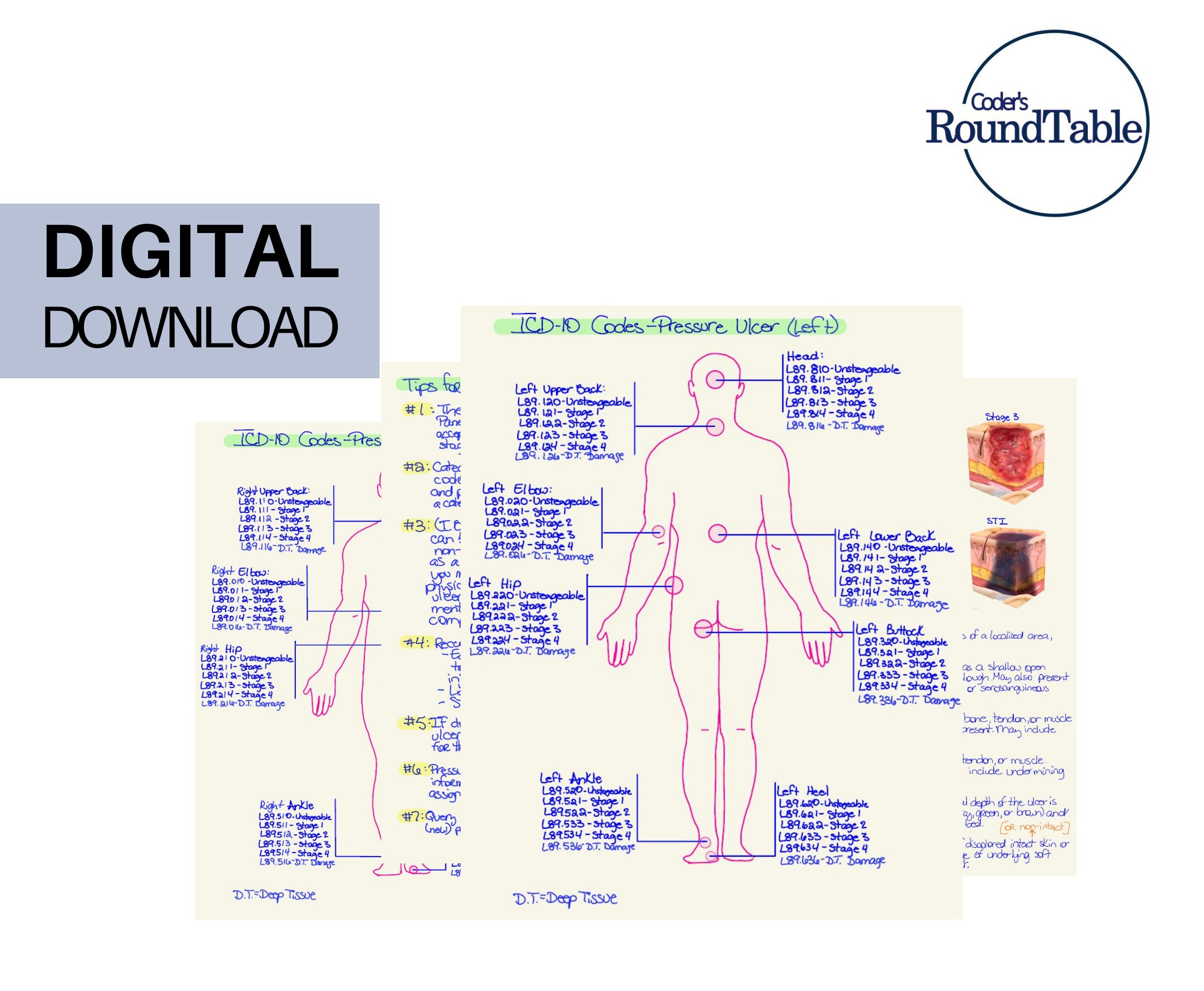 ICD 10 Pressure Ulcer Cheat Sheet Documentation Coding Tips Etsy