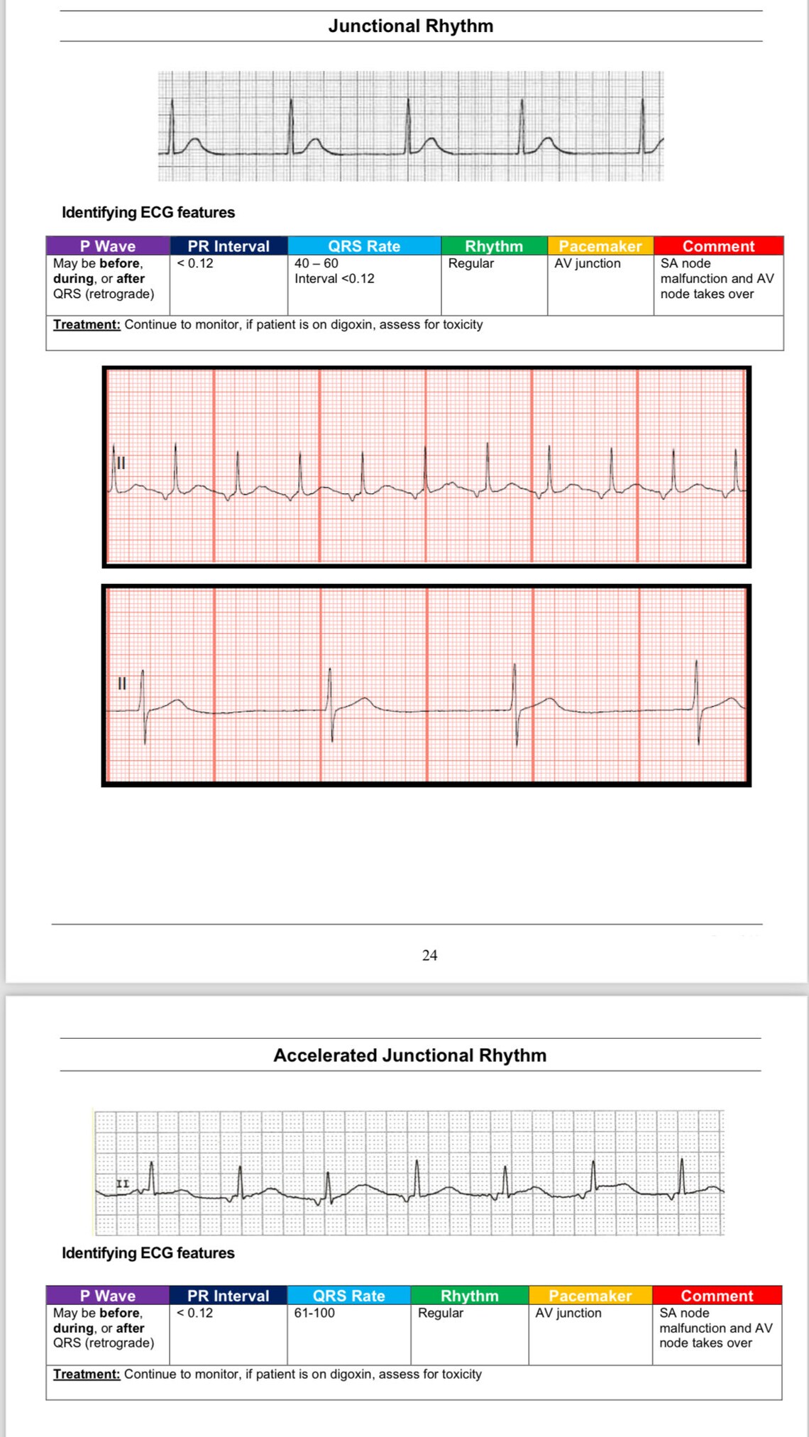 2024 Updated EKG/ECG Heart Arrhythmias Study Guide 55 Pages, 35 ...