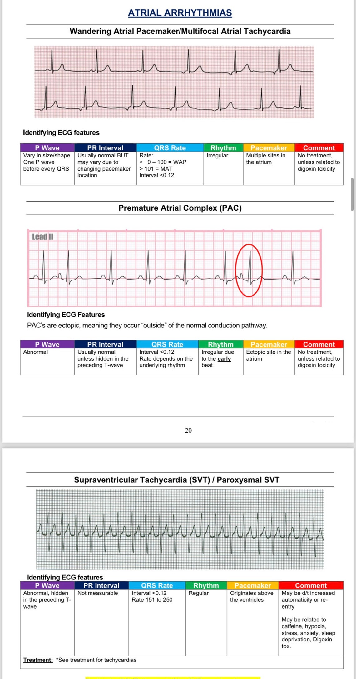 2024 Updated EKG/ECG Heart Arrhythmias Study Guide 55 Pages, 35 ...