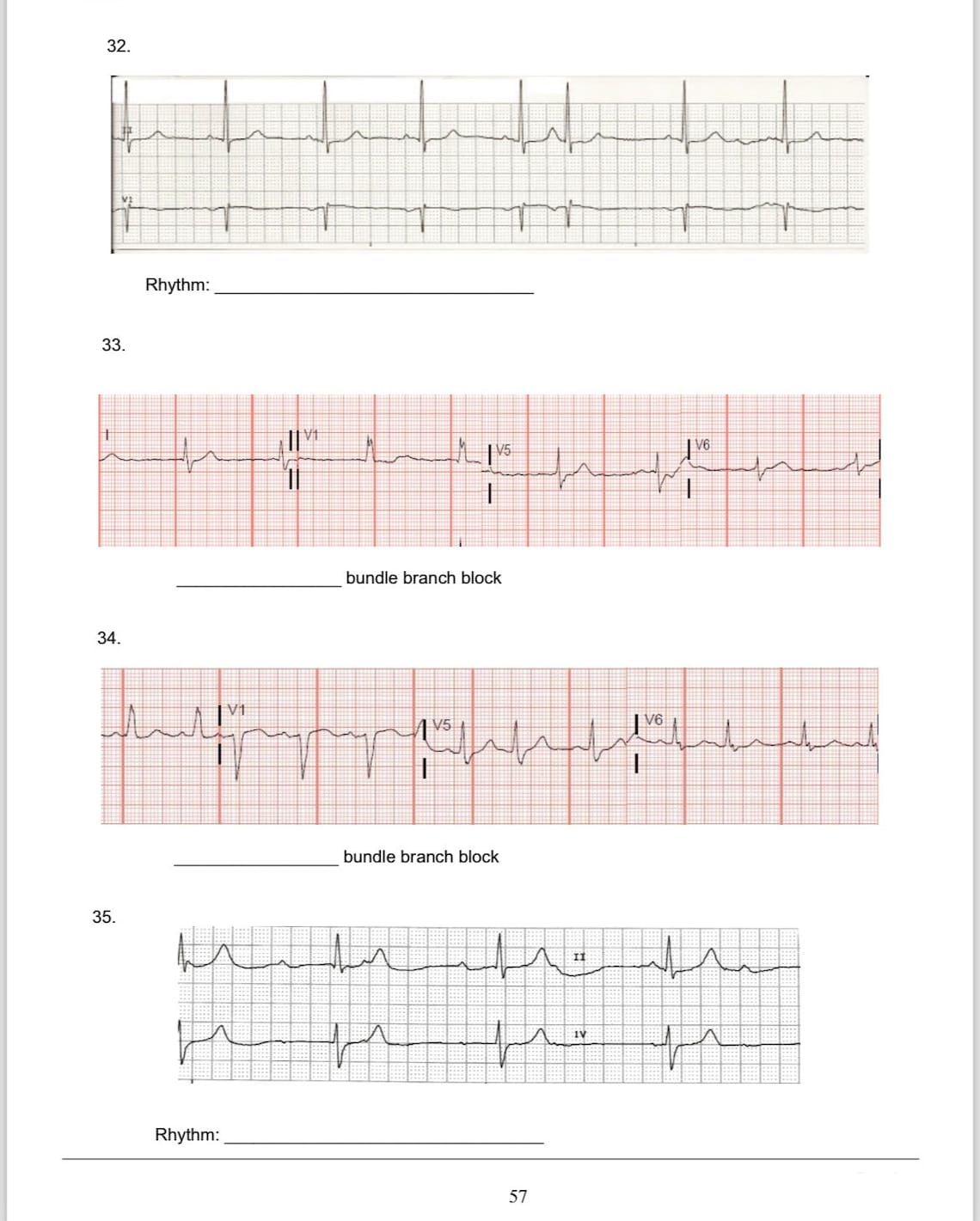 2024 Updated EKG/ECG Heart Arrhythmias Study Guide 55 Pages, 35 ...