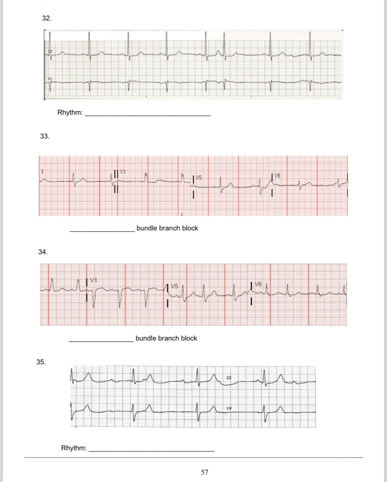 2024 Updated EKG/ECG Heart Arrhythmias Study Guide 55 Pages, 35 ...