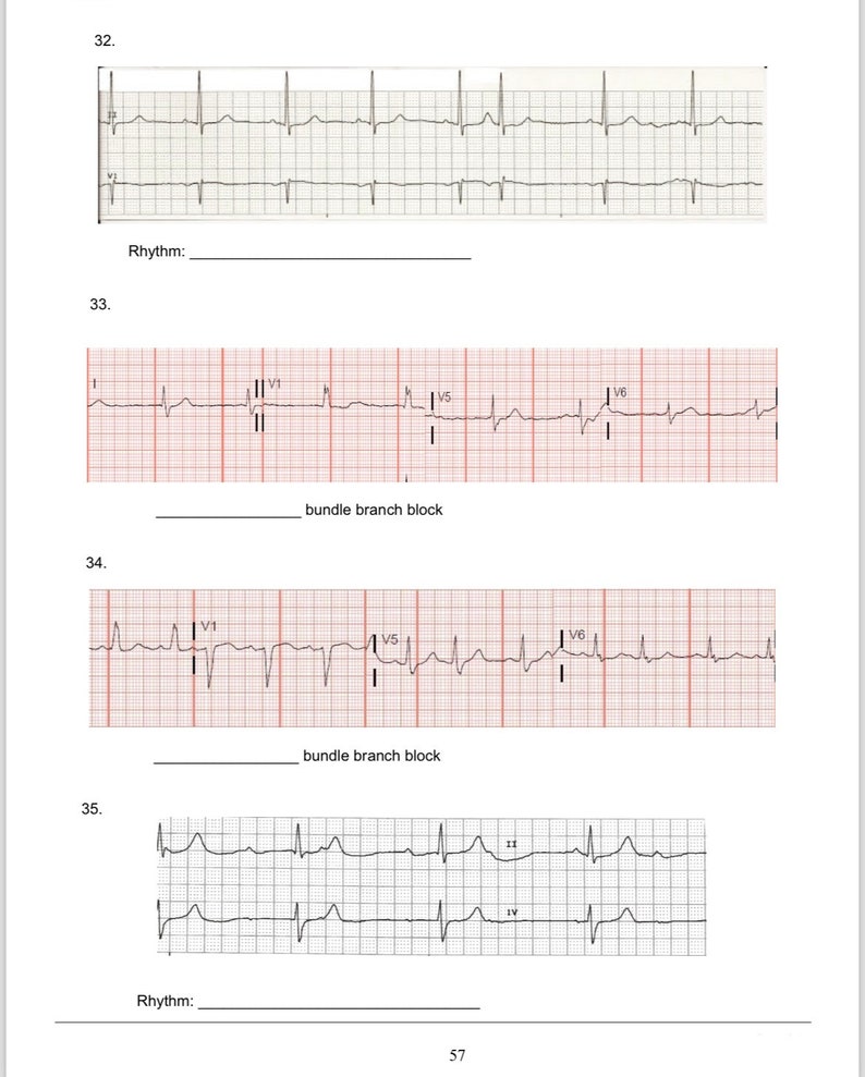2024 Updated EKG/ECG Heart Arrhythmias Study Guide 55 Pages, 35 ...