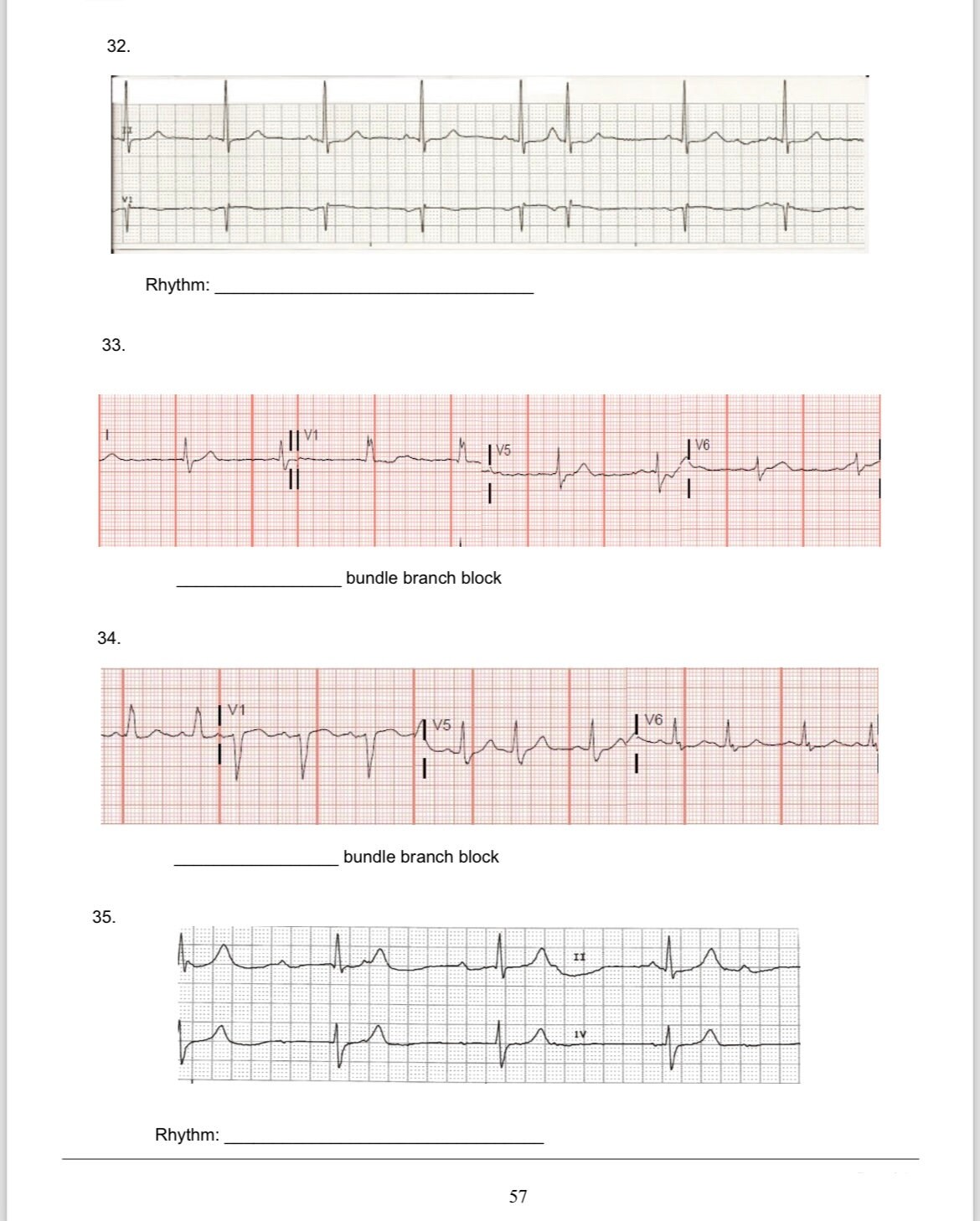 2024 Updated EKG/ECG Heart Arrhythmias Study Guide 55 Pages, 35 ...