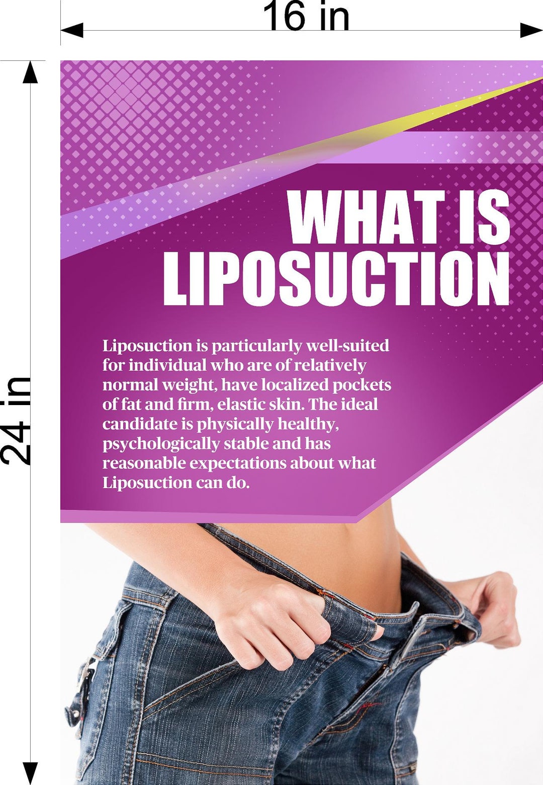 Liposuction 08 Photo-realistic Paper Poster Premium Inside Plastic ...