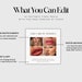 Lip Filler Flyer | Botox Flyers | Editable Social Media Canva Flyer ...