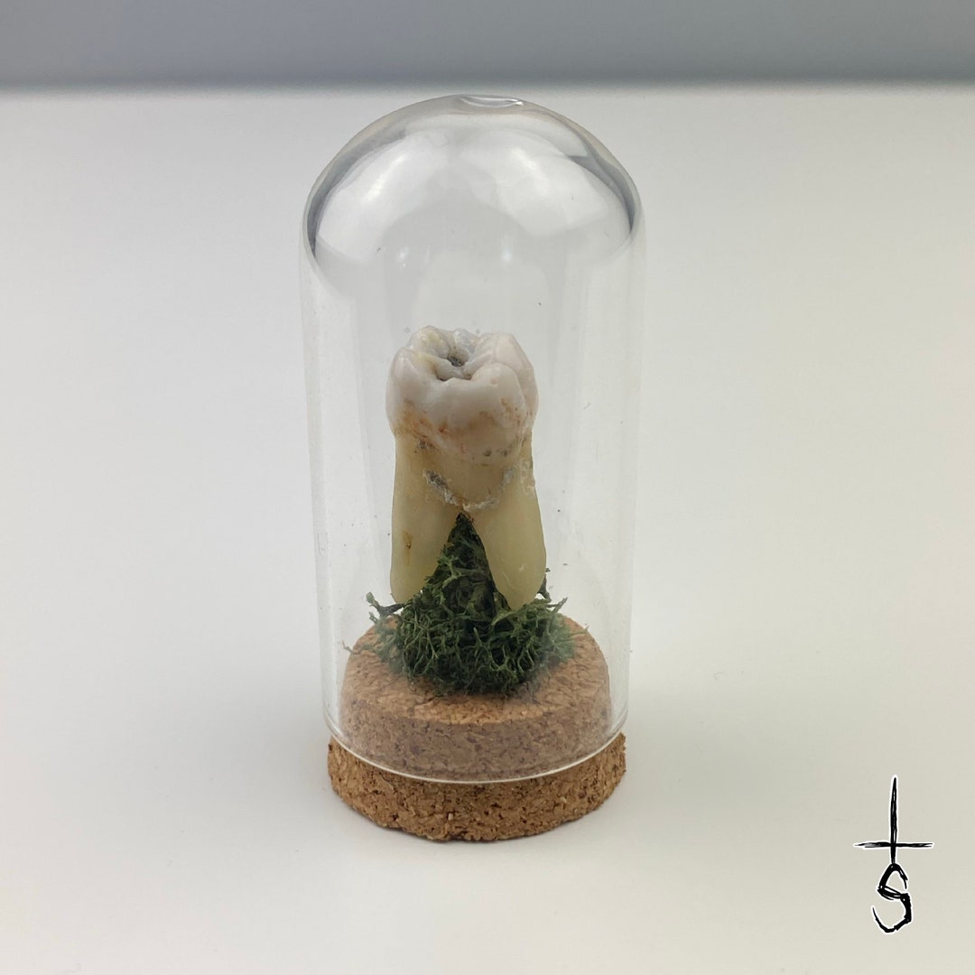 Molar With Filling Human Tooth Dome FREE SHIPPING - Etsy