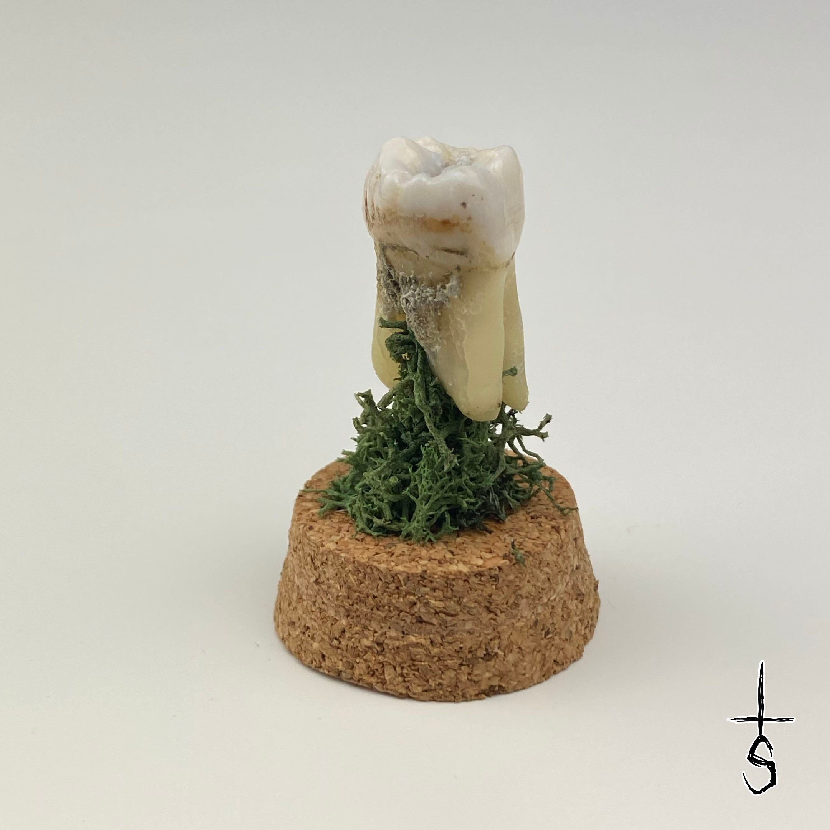 Molar With Filling Human Tooth Dome FREE SHIPPING - Etsy