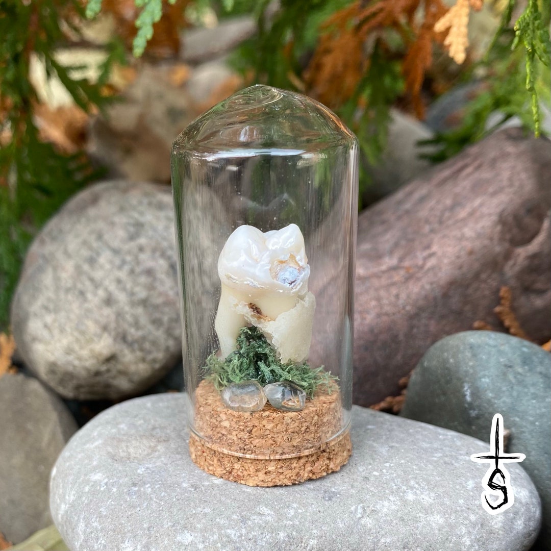 Human Tooth Dome Free Shipping - Etsy