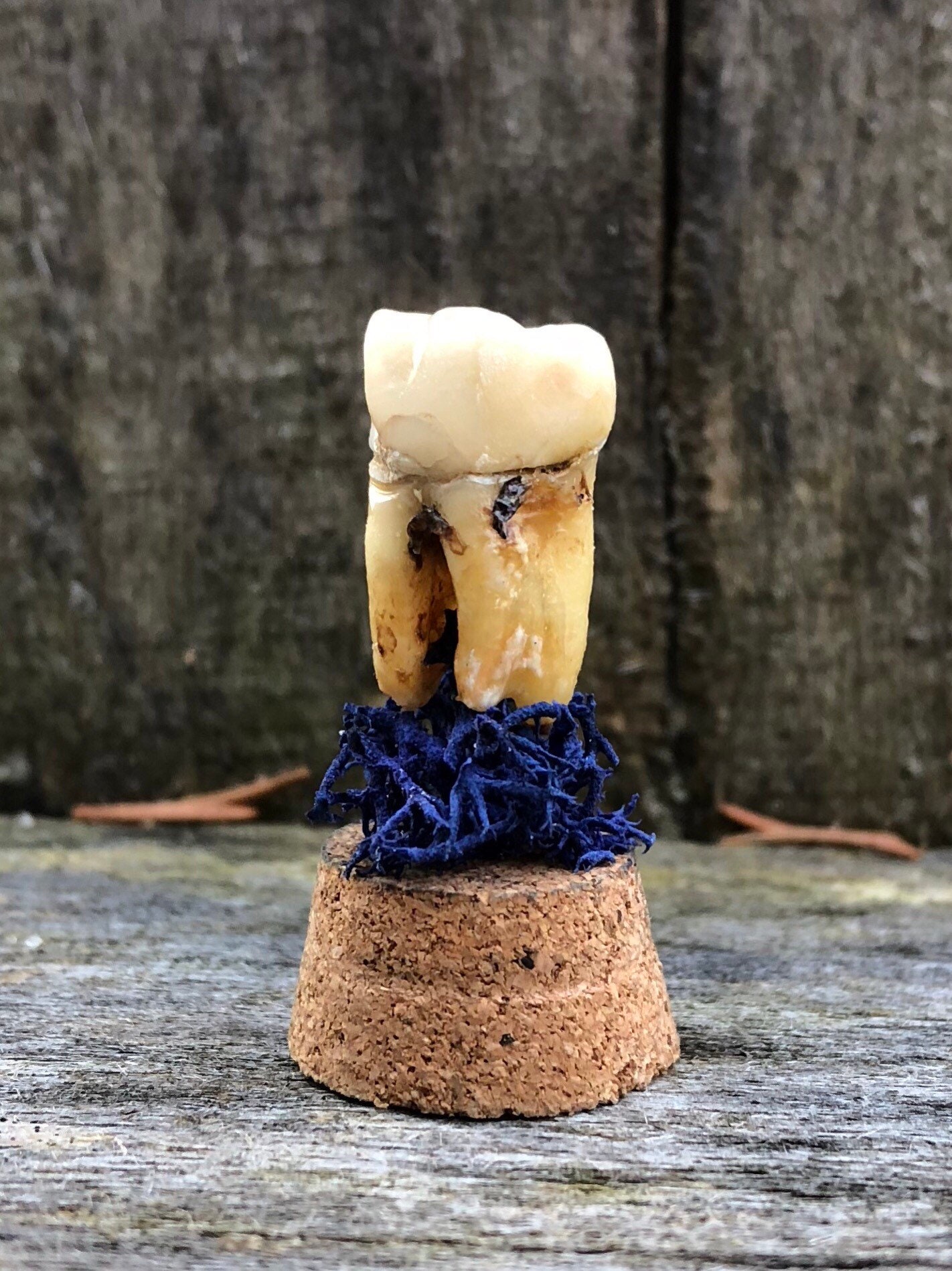 Gnarly Blue Moss Human Tooth Dome Free Shipping - Etsy