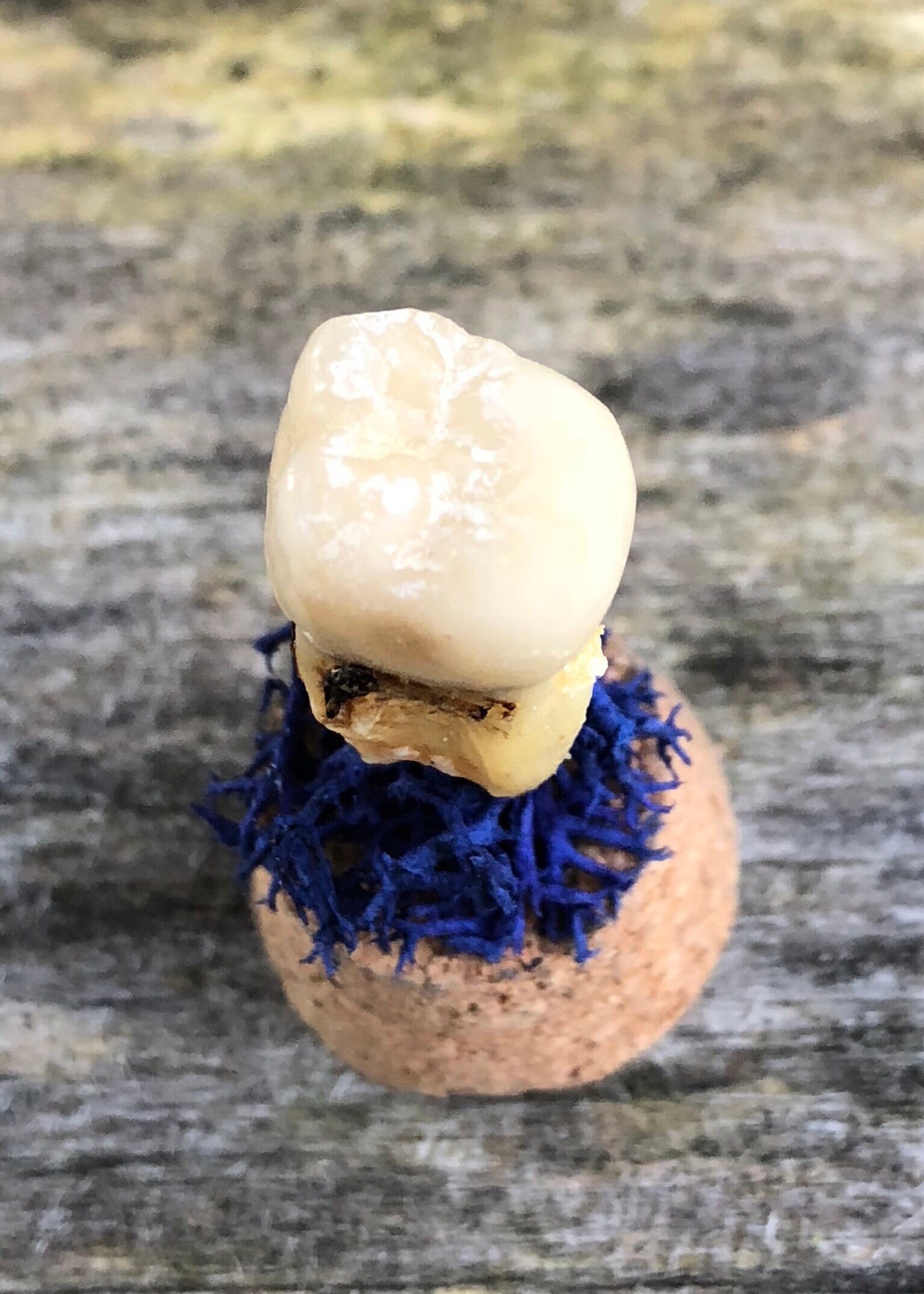 Gnarly Blue Moss Human Tooth Dome Free Shipping - Etsy