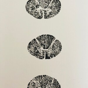 Anatomical Drawing Neuroscience Drawing Anatomy Art Spinal | Etsy